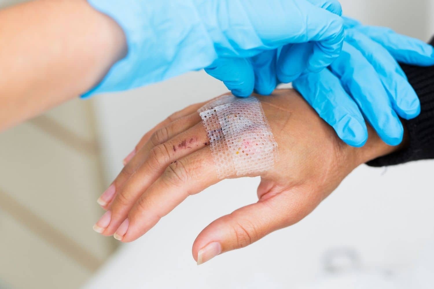 Artikel für die moderne Wundversorgung günstig online kaufen | MaskMedicare