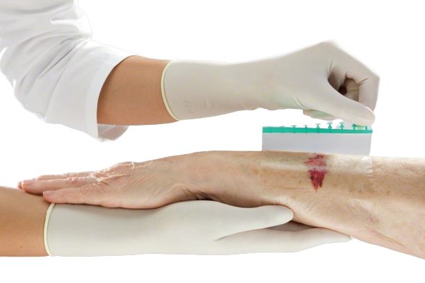 Askina® Derm transparenter Wundverband 6 cm x 7 cm | 102890