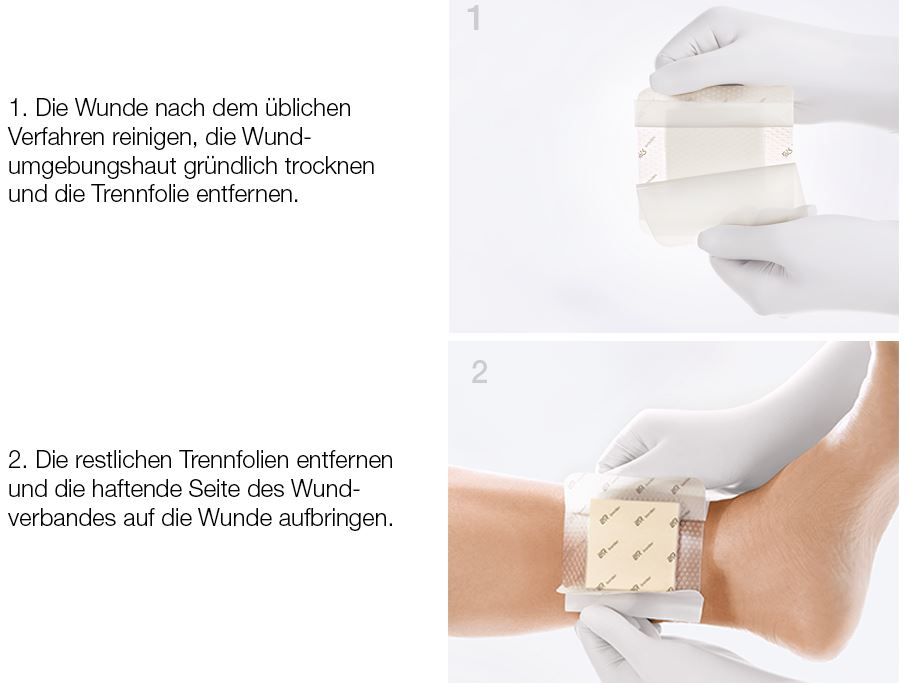 Suprasorb P sensitive PU-Schaumverband border steril 10 cm x 10 cm | 10 ...